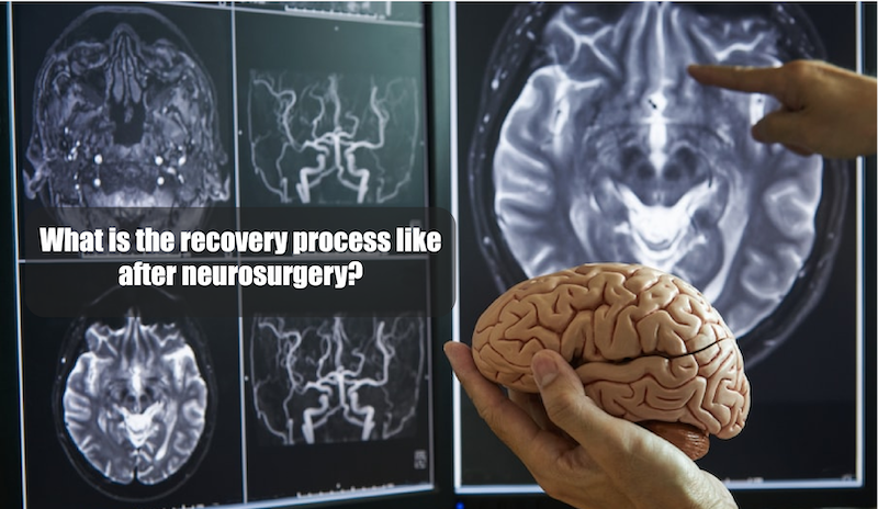 What is the Recovery Process Like After Neurosurgery? - Dr Baker ...
